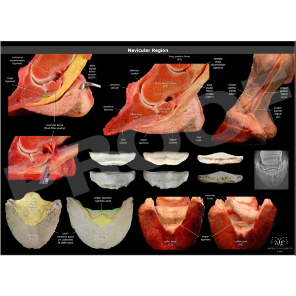 Plakat – Navicular Region – Ib Jessen ApS